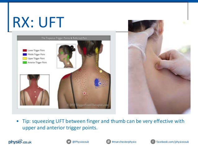 Trigger point presentation workshop 01.04.17