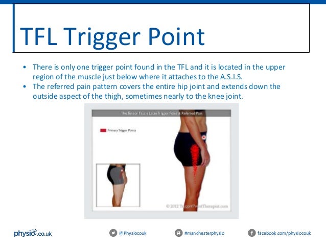 Trigger point presentation workshop 01.04.17