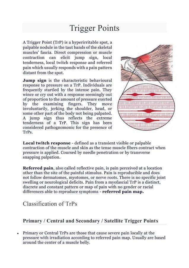 Trigger points & Tender Points | PDF | Physical Therapy | Wellness