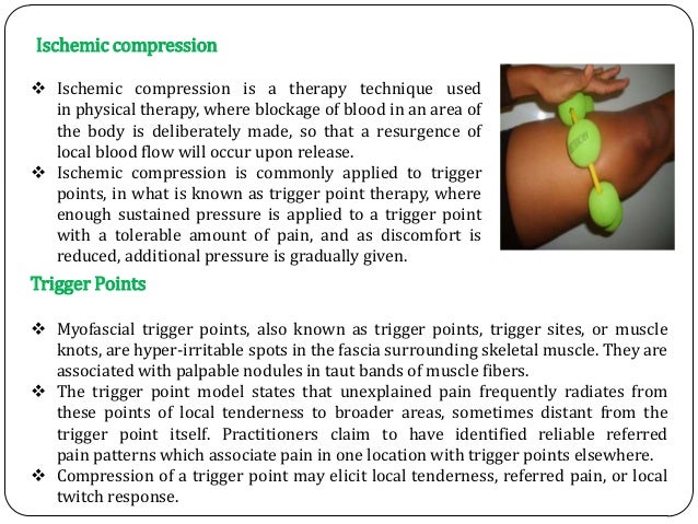 Trigger Point Therapy