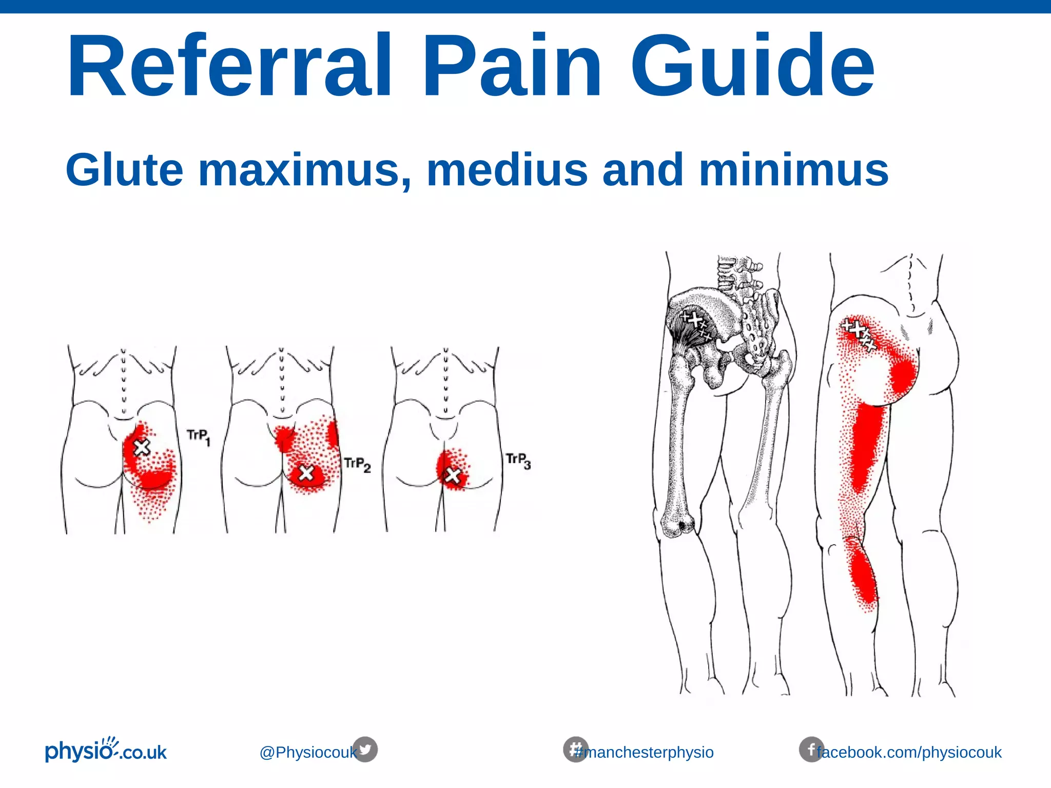 Trigger Point Therapy Slides | PPT