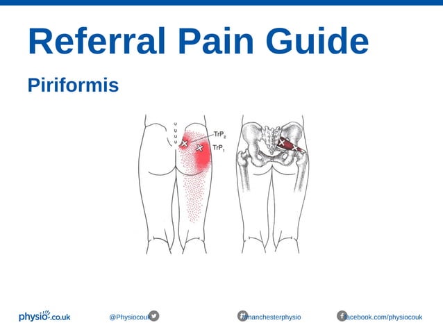 Trigger Point Therapy Slides | PPT