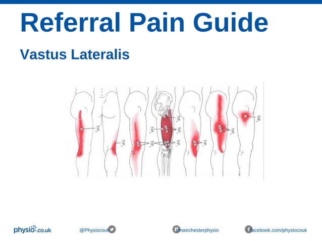 Trigger Point Therapy Slides | PPT
