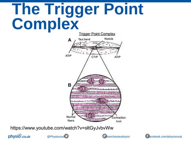 Trigger Point Therapy Slides | PPT