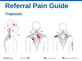Trapezius Trigger Points Referred Pain
