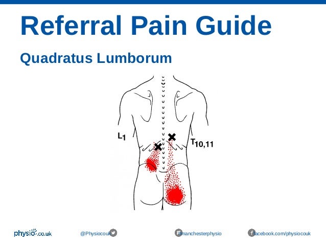 Trigger Point Therapy Slides
