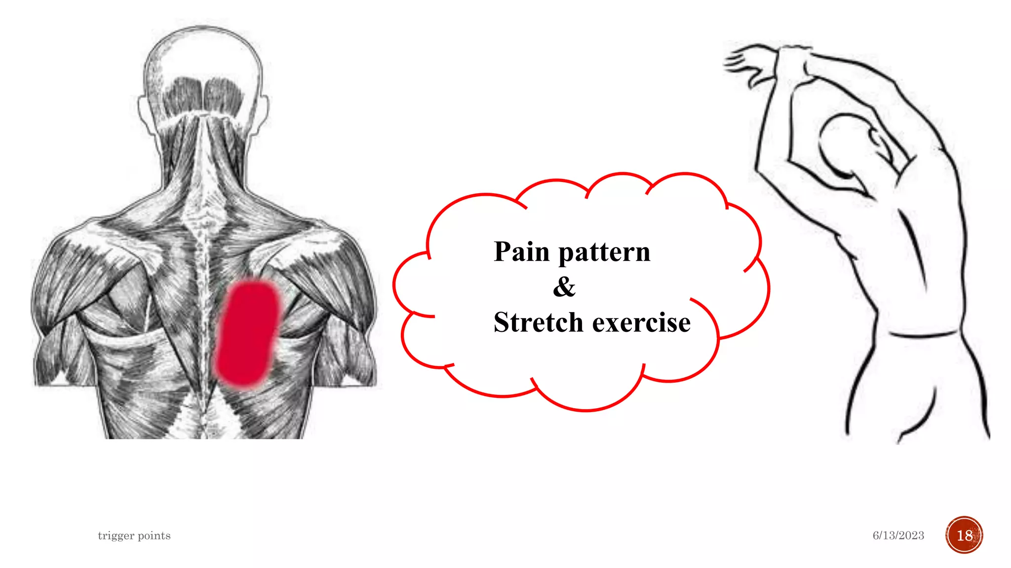 Trigger point therapy .pptx