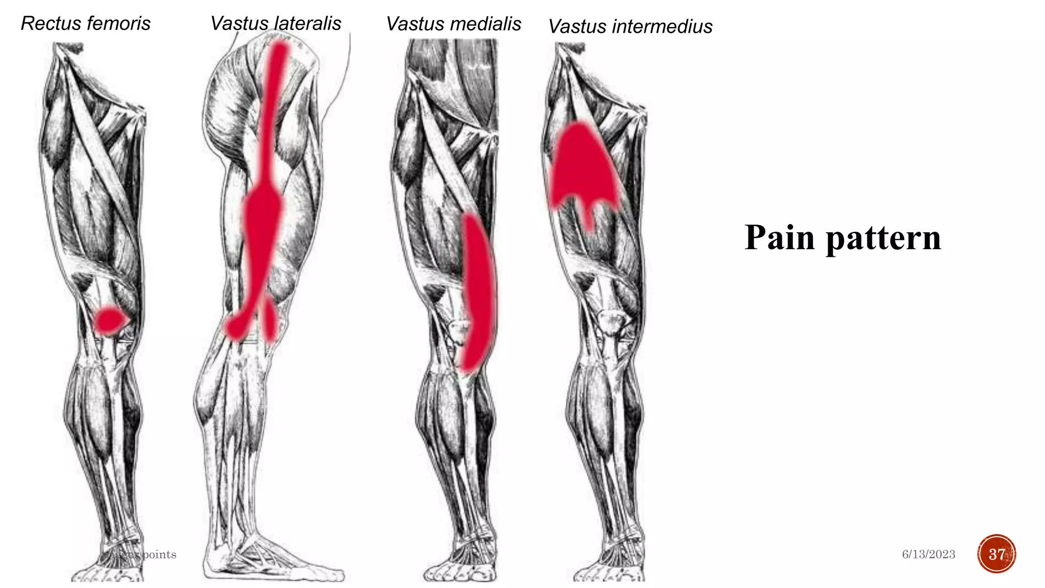 Trigger point therapy .pptx