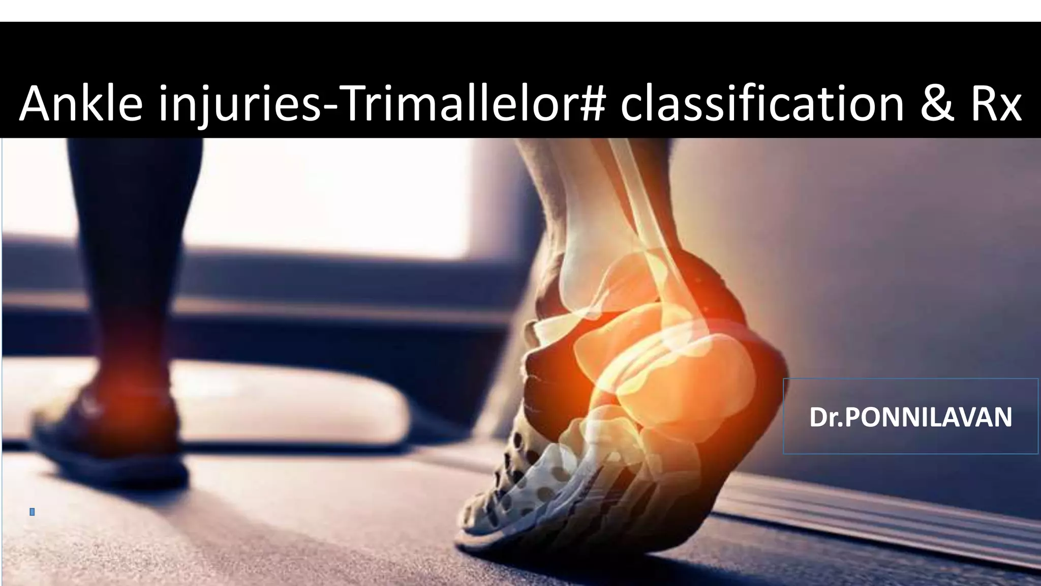 Ankle injuries & Trimallelor fracture classification | PPTX