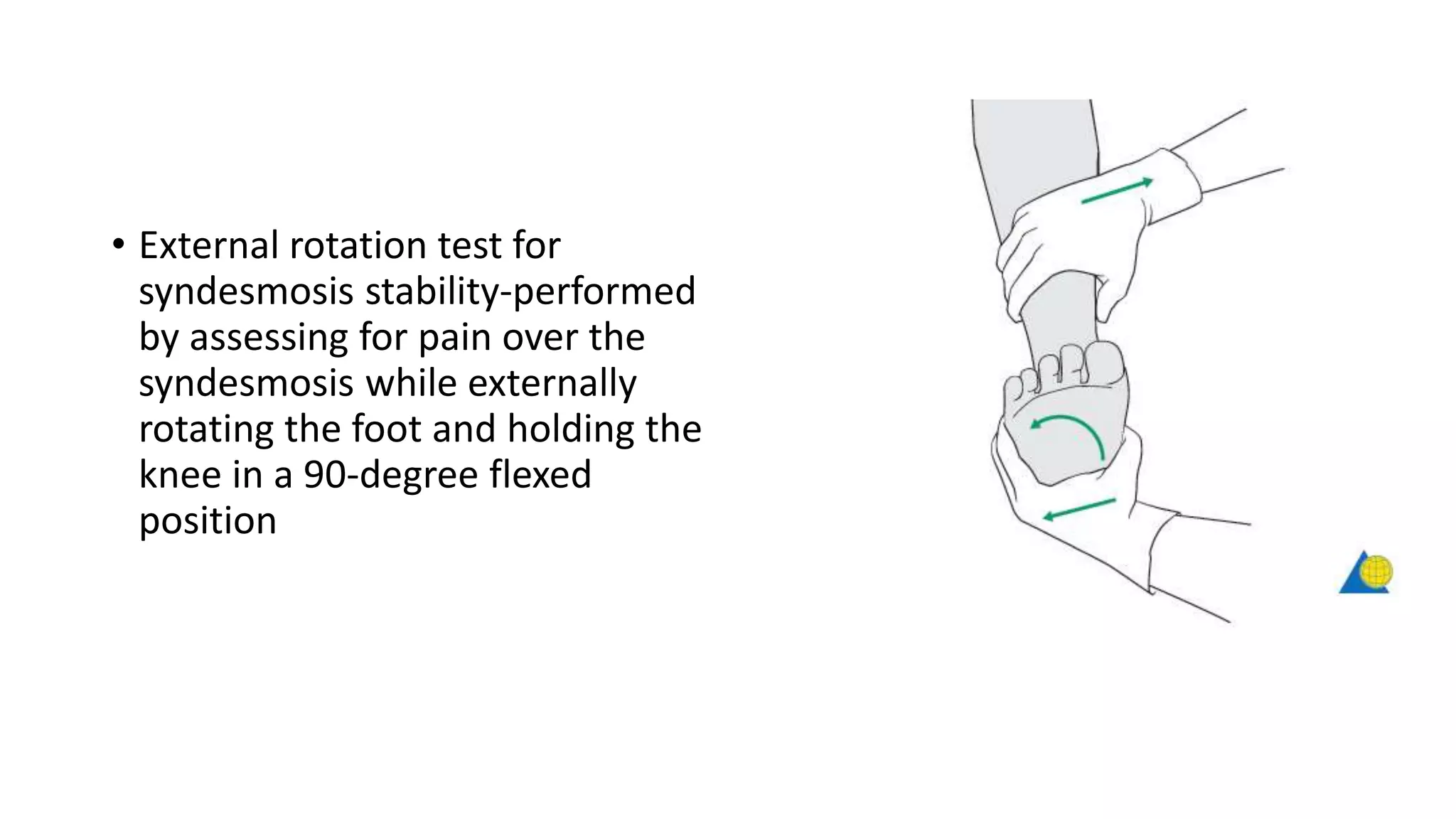 Ankle injuries & Trimallelor fracture classification | PPTX