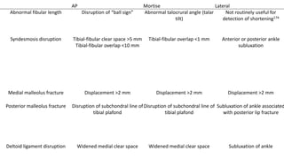 Ankle injuries & Trimallelor fracture classification | PPTX