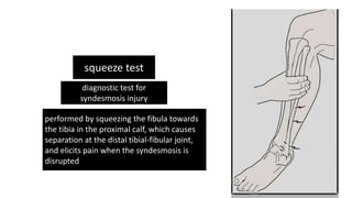 Ankle injuries & Trimallelor fracture classification | PPTX