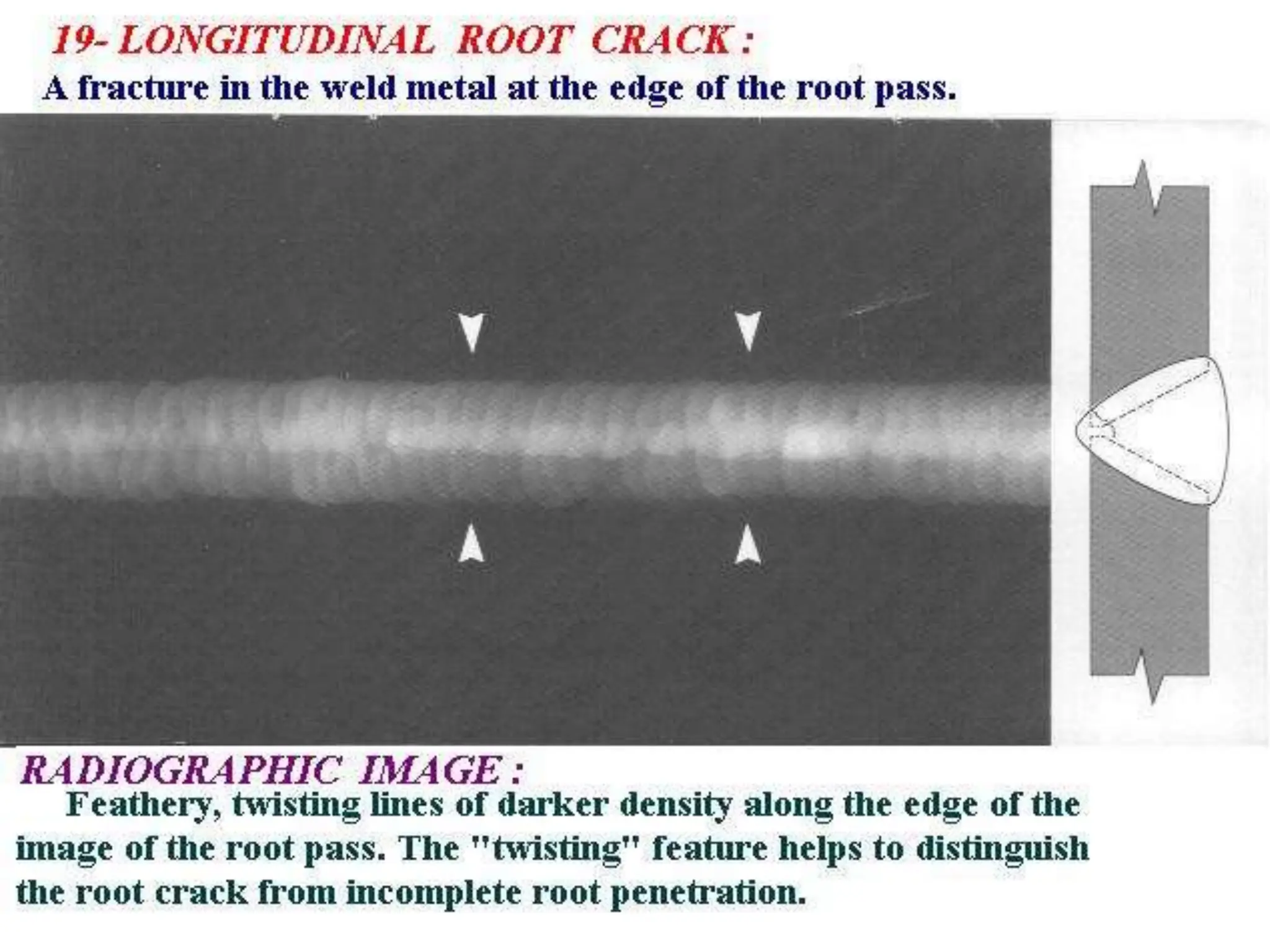 Types of Radio Graphic (RT) Weld Examination Defects.ppt | Medical ...