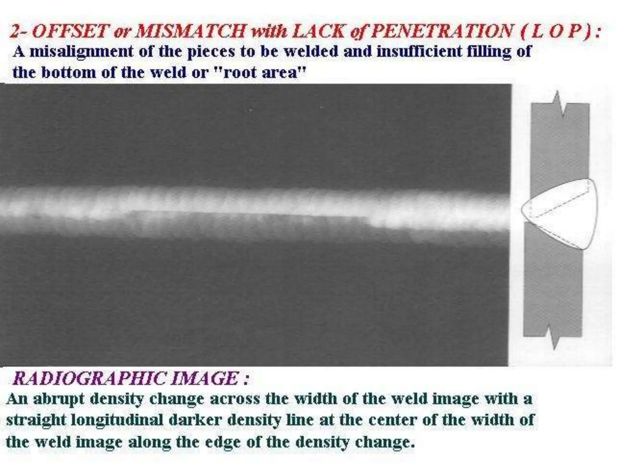 Types of Radio Graphic (RT) Weld Examination Defects.ppt | Medical ...