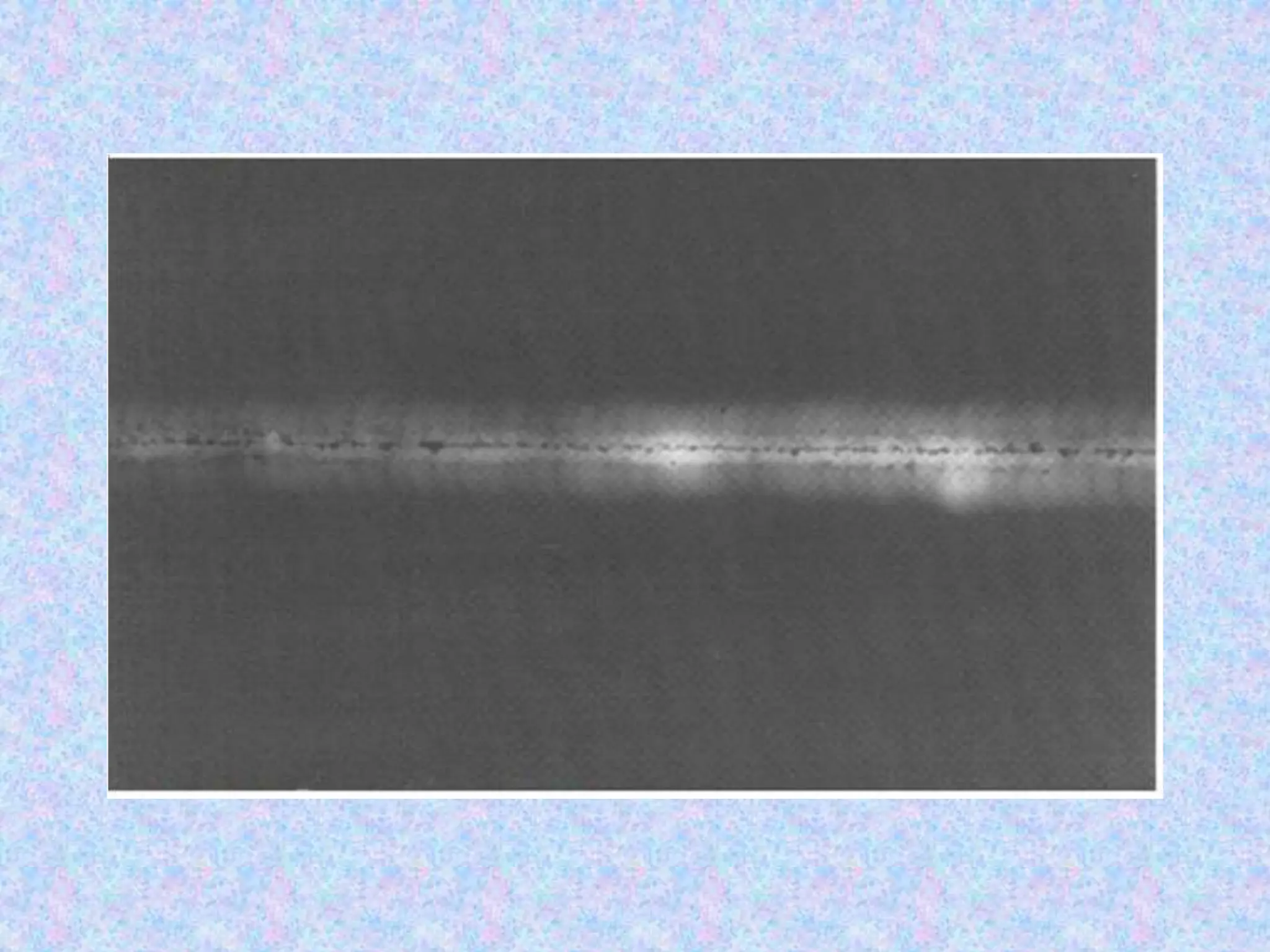 Types of Radio Graphic (RT) Weld Examination Defects.ppt | Medical ...