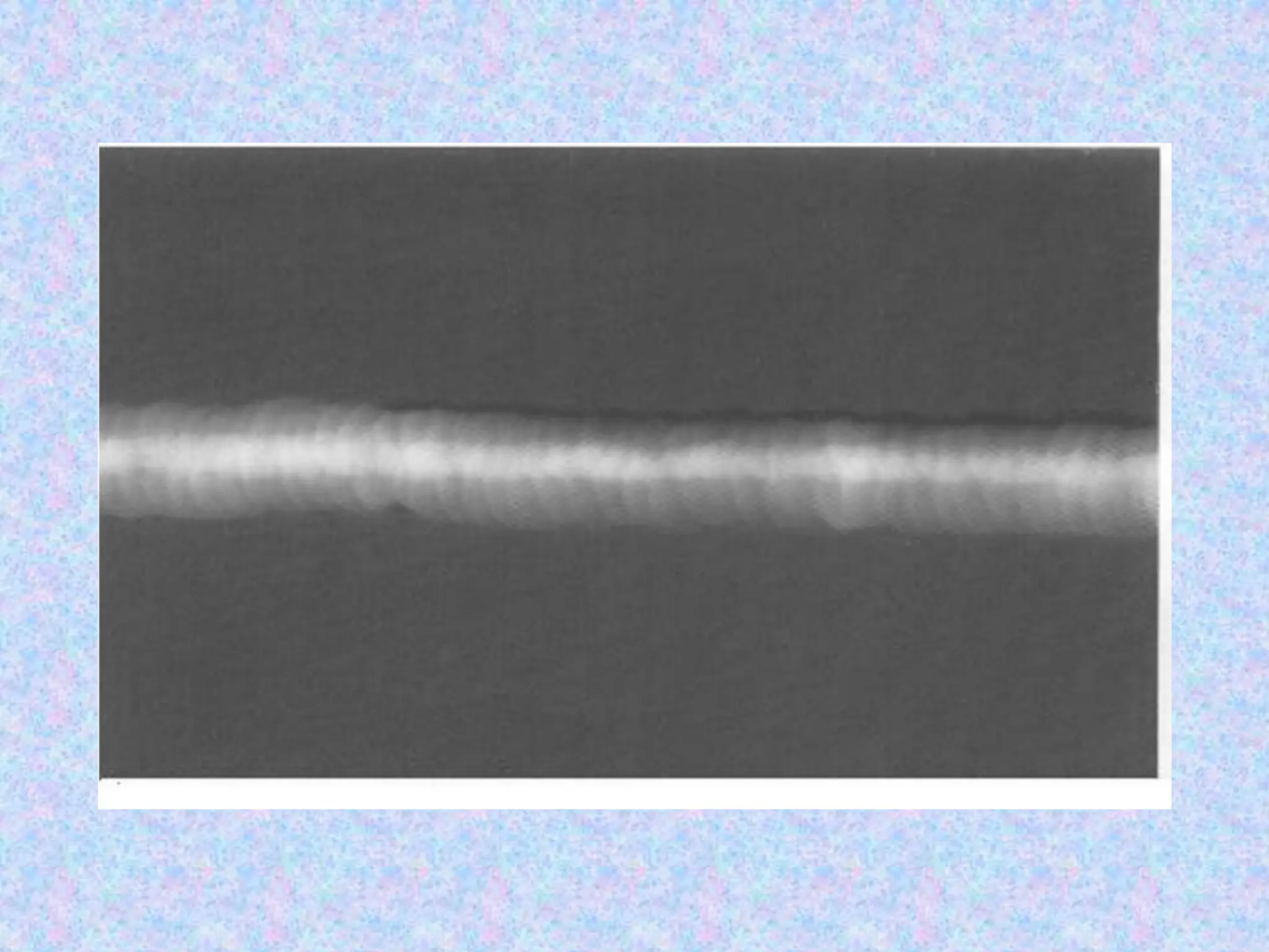 Types of Radio Graphic (RT) Weld Examination Defects.ppt