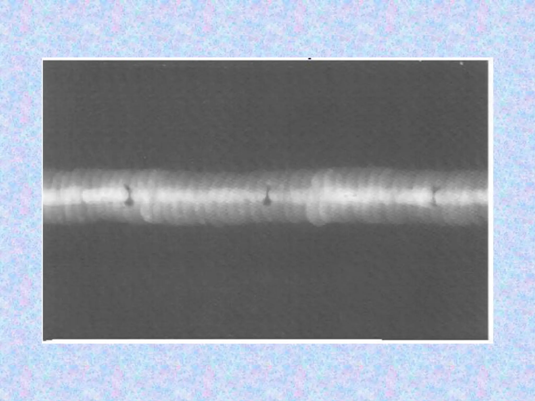 Types of Radio Graphic (RT) Weld Examination Defects.ppt | Medical ...