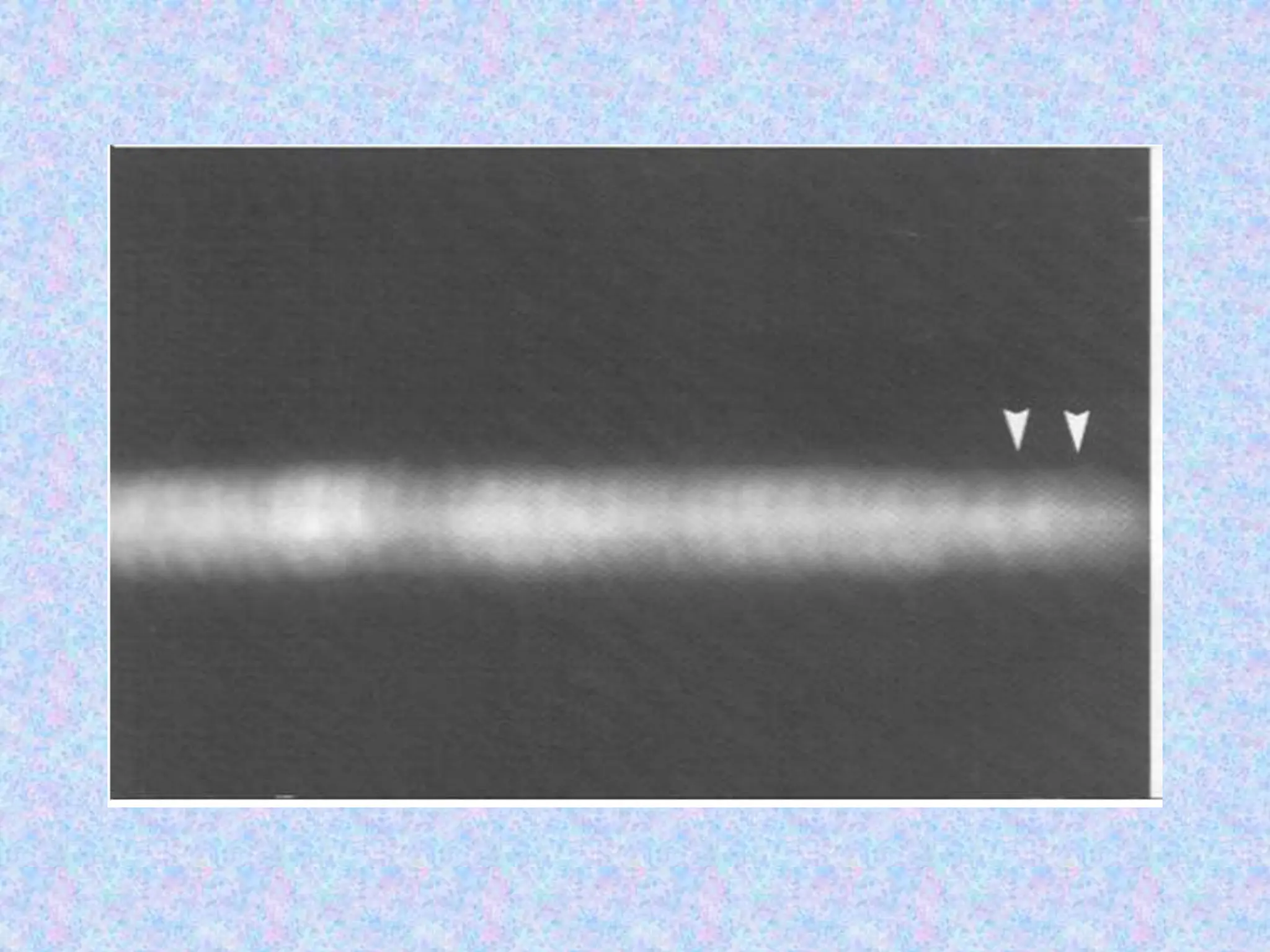 Types of Radio Graphic (RT) Weld Examination Defects.ppt