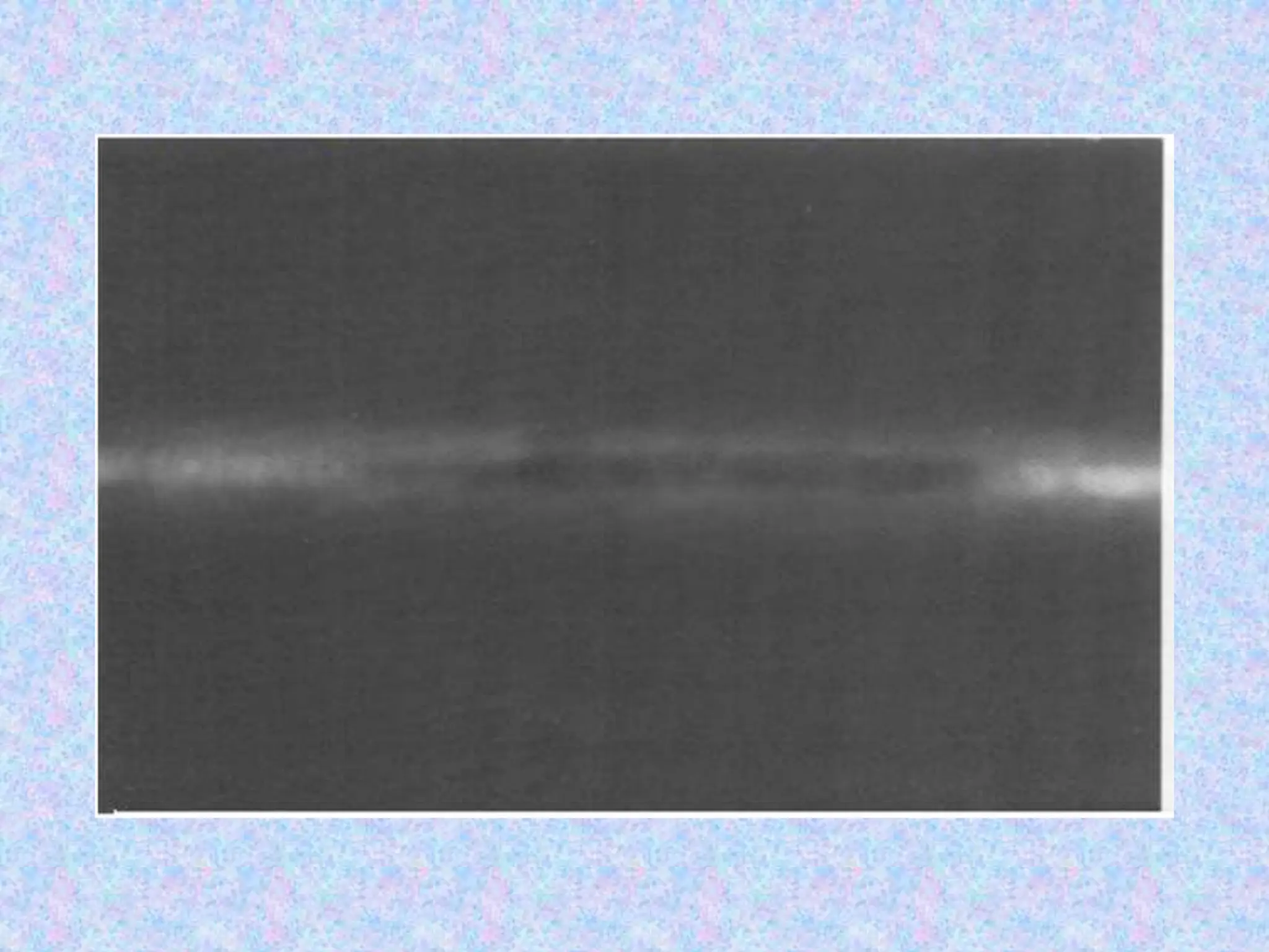 Types of Radio Graphic (RT) Weld Examination Defects.ppt | Medical ...