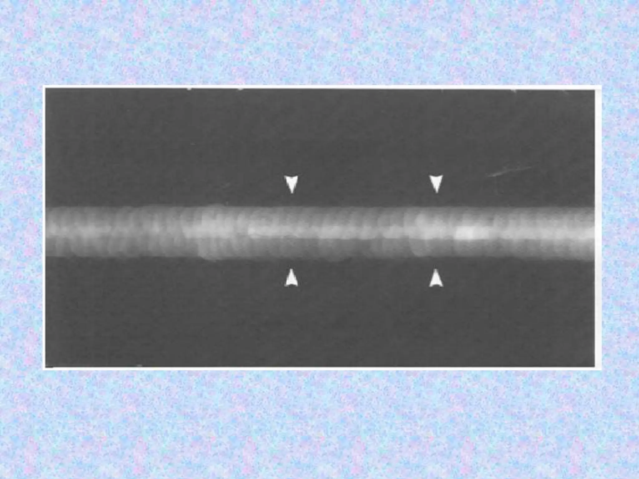 Types of Radio Graphic (RT) Weld Examination Defects.ppt | Medical ...