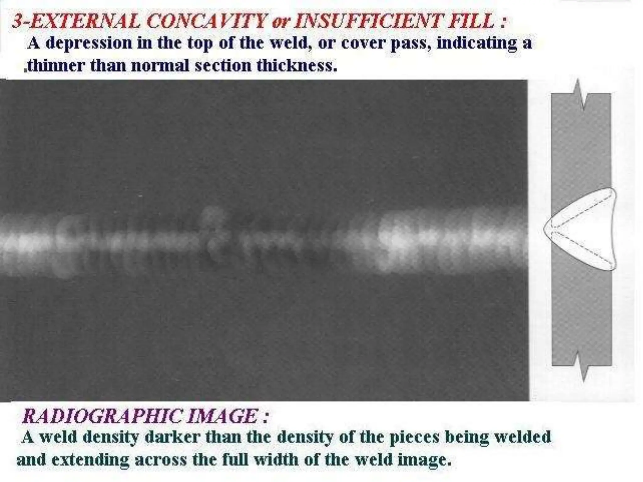 Types Of Radio Graphic Rt Weld Examination Defects Ppt Medical Tests Medical Health