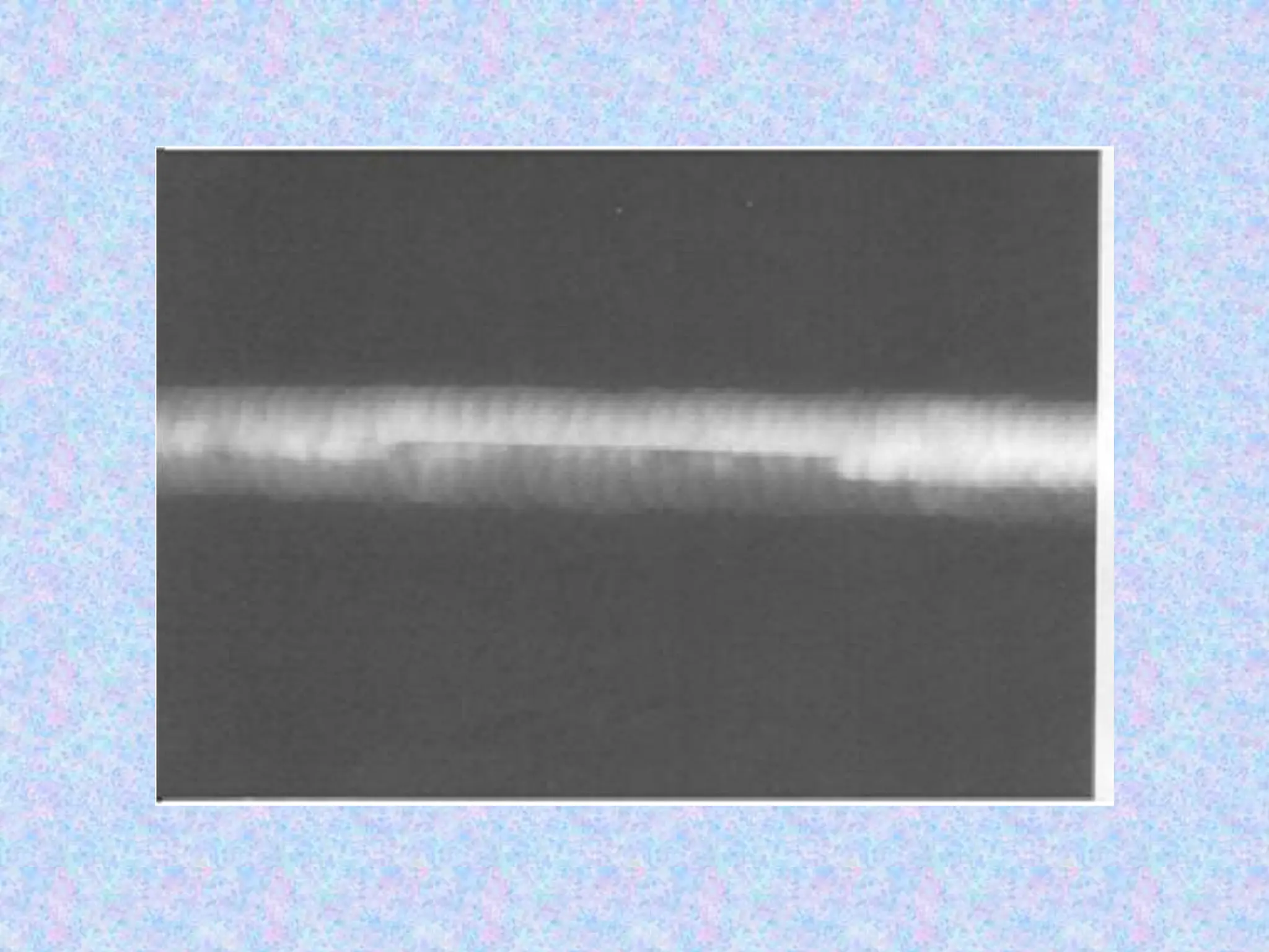 Types of Radio Graphic (RT) Weld Examination Defects.ppt