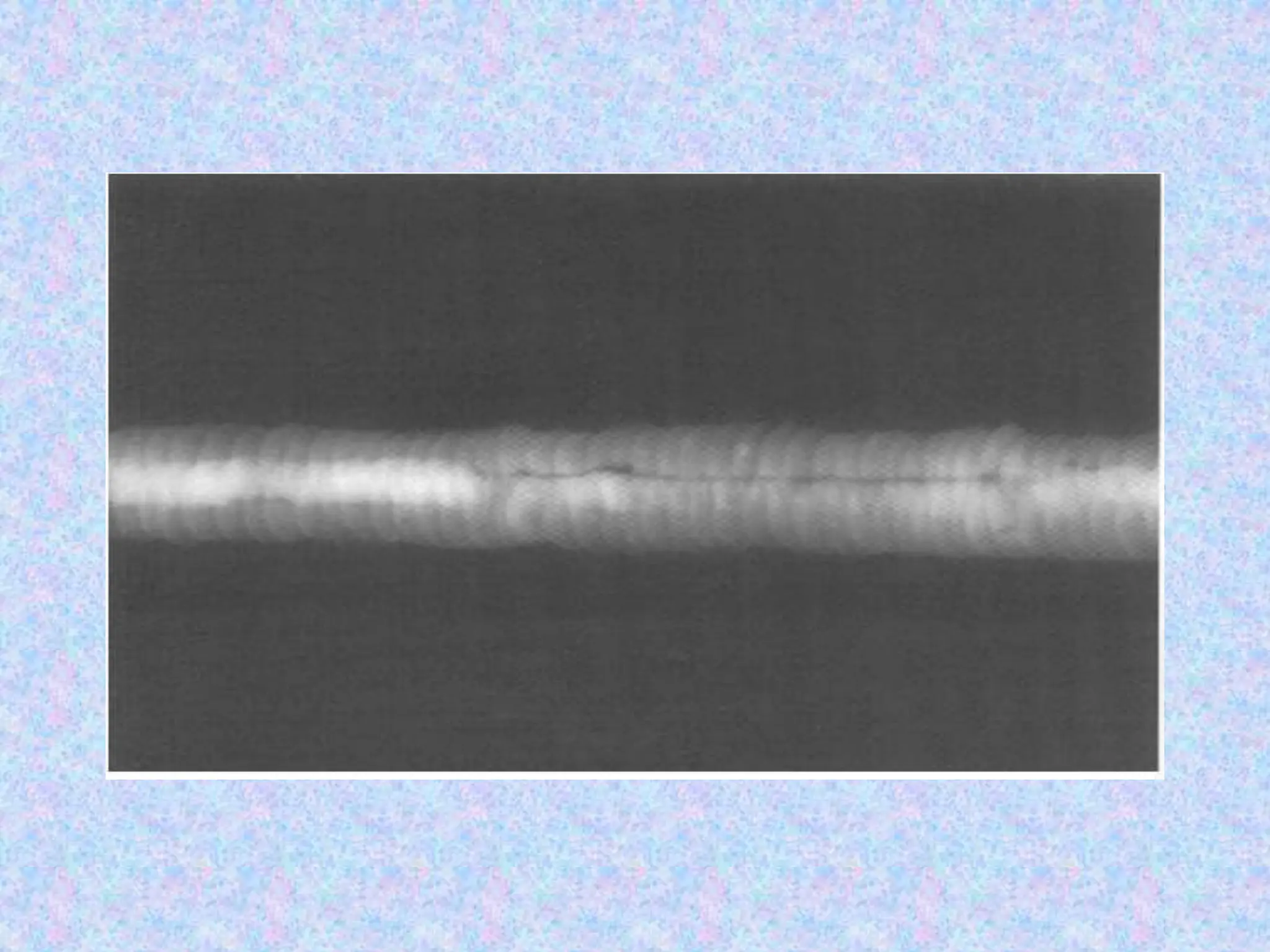 Types of Radio Graphic (RT) Weld Examination Defects.ppt | Medical ...