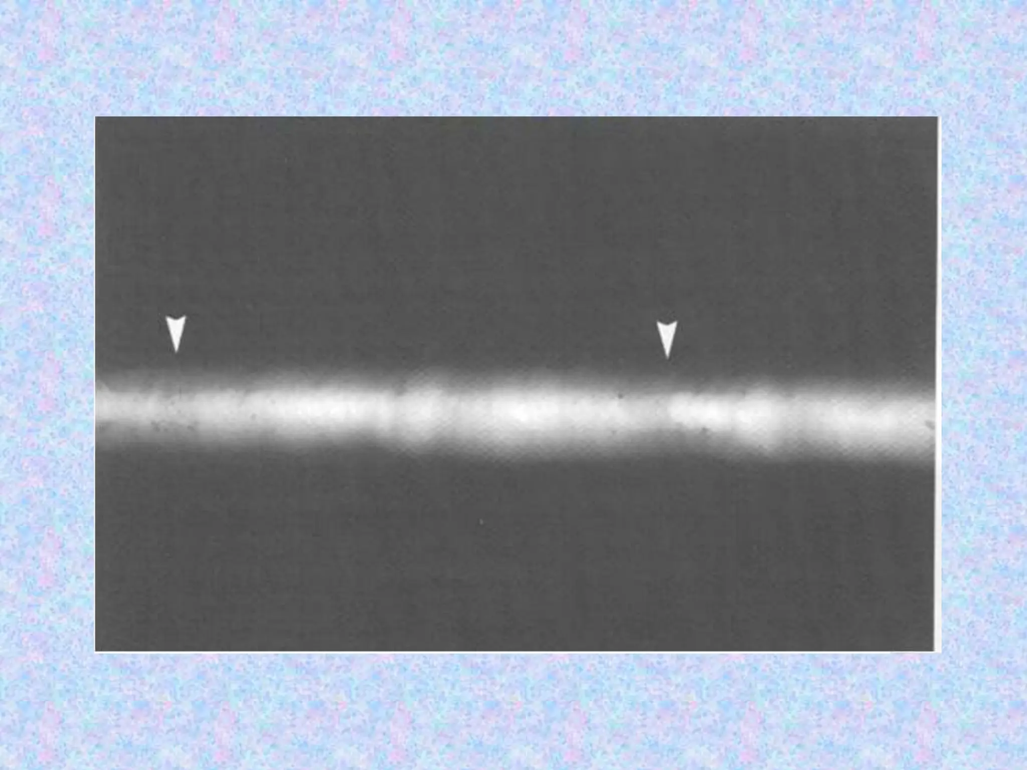 Types of Radio Graphic (RT) Weld Examination Defects.ppt | Medical ...