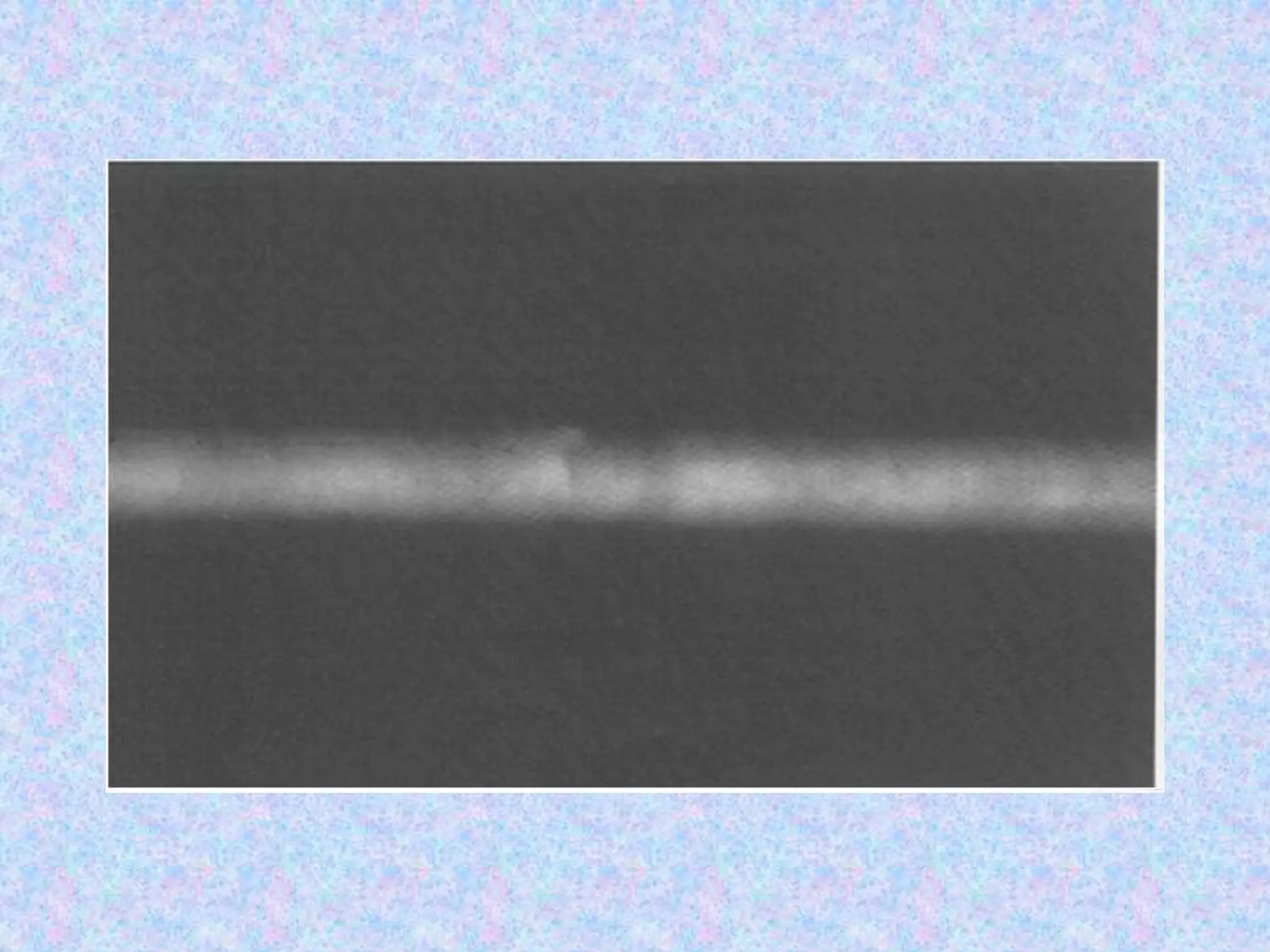 Types Of Radio Graphic Rt Weld Examination Defects Ppt Medical Tests Medical Health