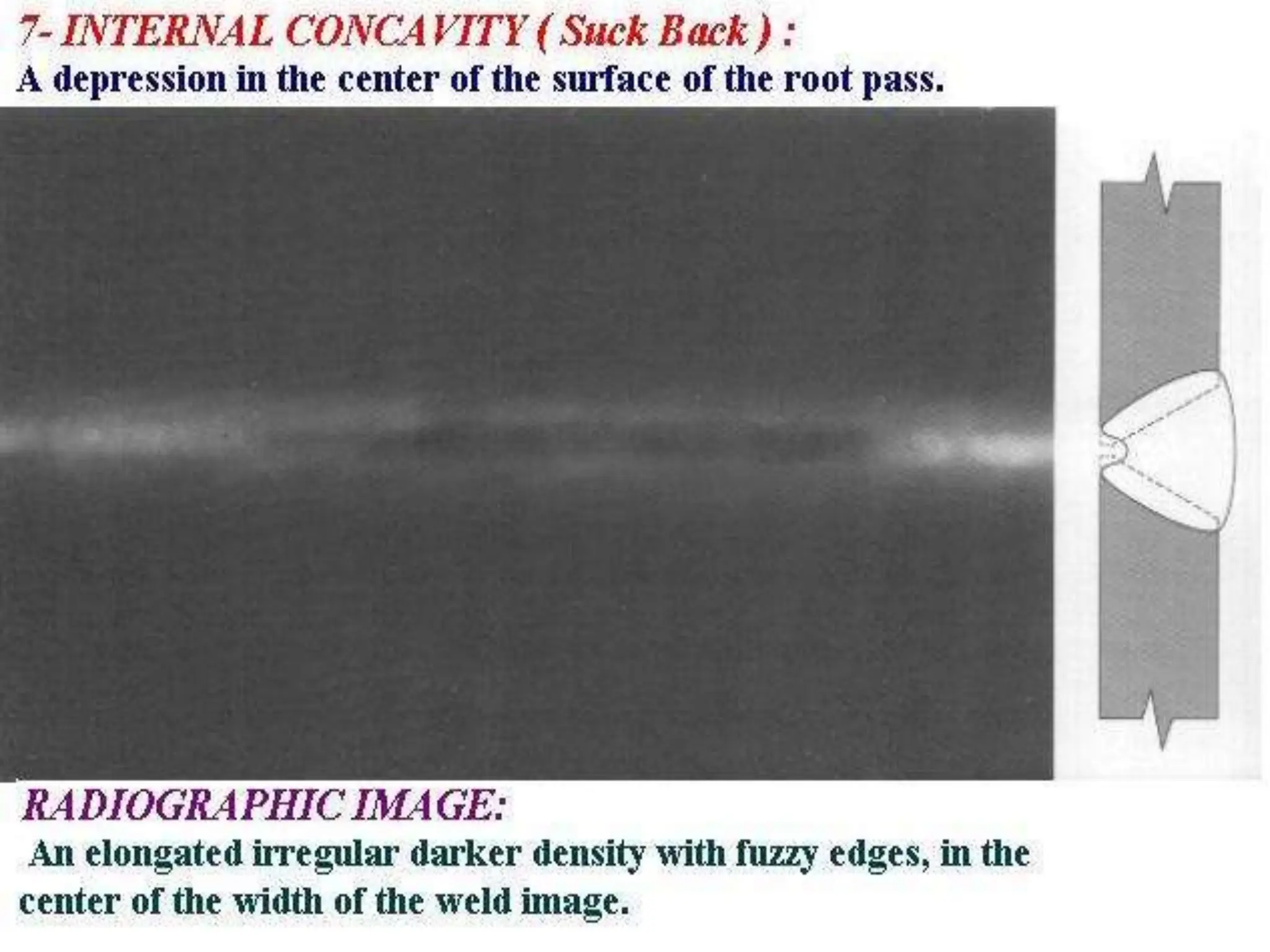Types of Radio Graphic (RT) Weld Examination Defects.ppt | Medical ...