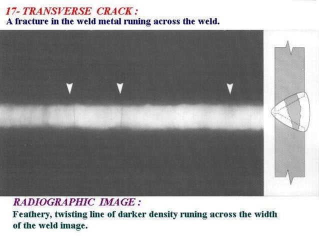 Types of Radio Graphic (RT) Weld Examination Defects.ppt | Medical ...