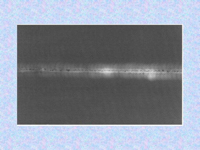 Types of Radio Graphic (RT) Weld Examination Defects.ppt | Medical ...