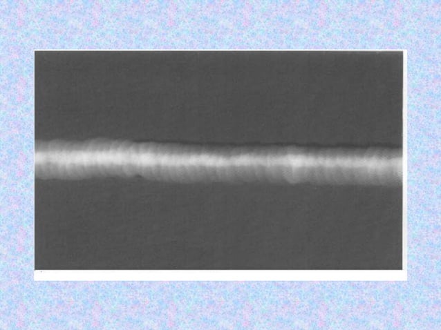 Types of Radio Graphic (RT) Weld Examination Defects.ppt | Medical ...