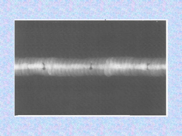 Types of Radio Graphic (RT) Weld Examination Defects.ppt | Medical ...