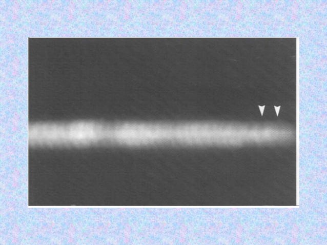 Types of Radio Graphic (RT) Weld Examination Defects.ppt | Medical ...