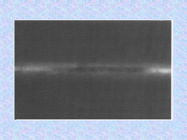 Types of Radio Graphic (RT) Weld Examination Defects.ppt | Medical ...