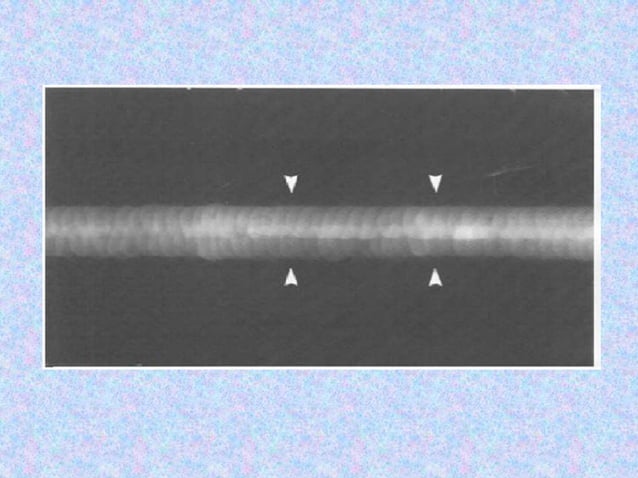 Types of Radio Graphic (RT) Weld Examination Defects.ppt | Medical ...