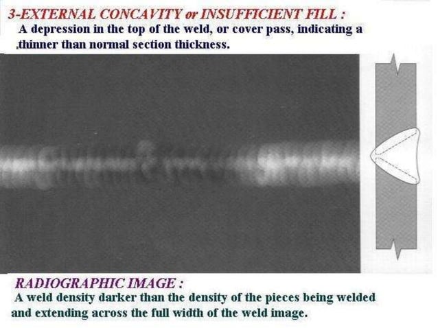 Types of Radio Graphic (RT) Weld Examination Defects.ppt | Medical ...