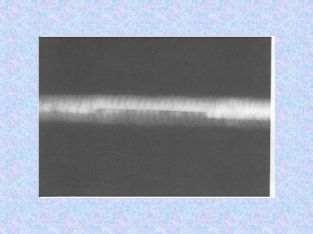 Types of Radio Graphic (RT) Weld Examination Defects.ppt | Medical ...