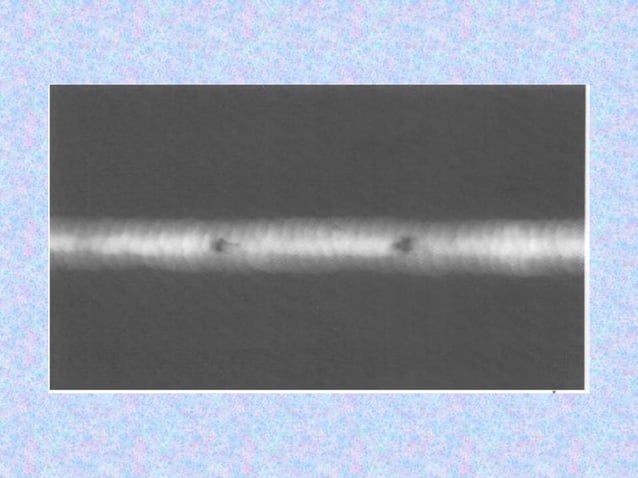 Types of Radio Graphic (RT) Weld Examination Defects.ppt | Medical ...
