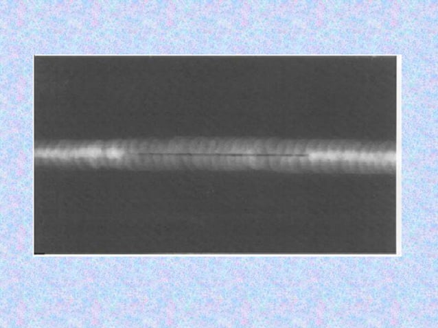 Types of Radio Graphic (RT) Weld Examination Defects.ppt | Medical ...