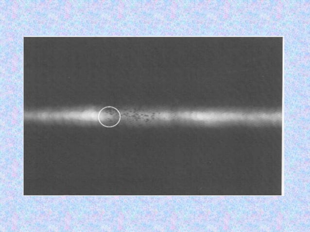 Types of Radio Graphic (RT) Weld Examination Defects.ppt | Medical ...