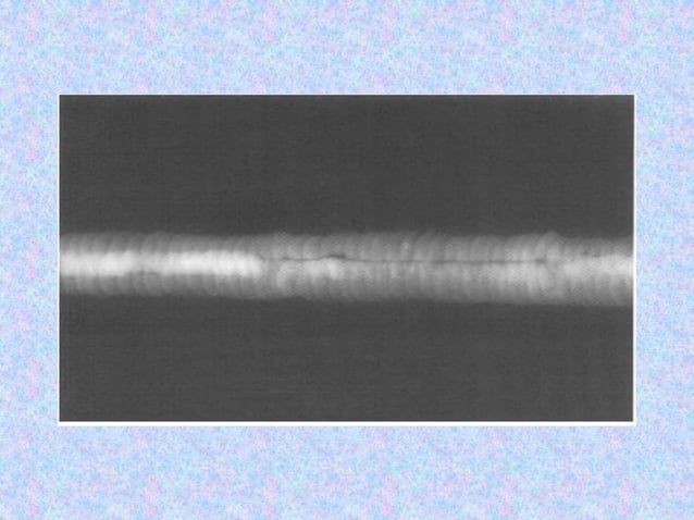 Types of Radio Graphic (RT) Weld Examination Defects.ppt | Medical ...