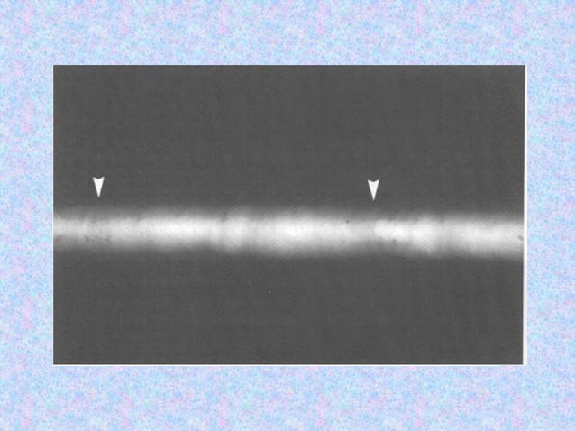Types of Radio Graphic (RT) Weld Examination Defects.ppt | Medical ...