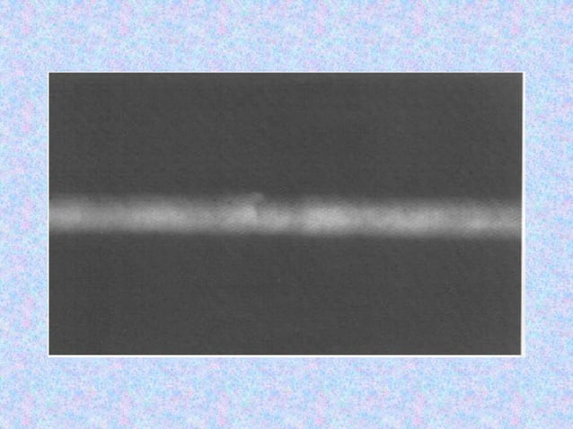 Types of Radio Graphic (RT) Weld Examination Defects.ppt | Medical ...