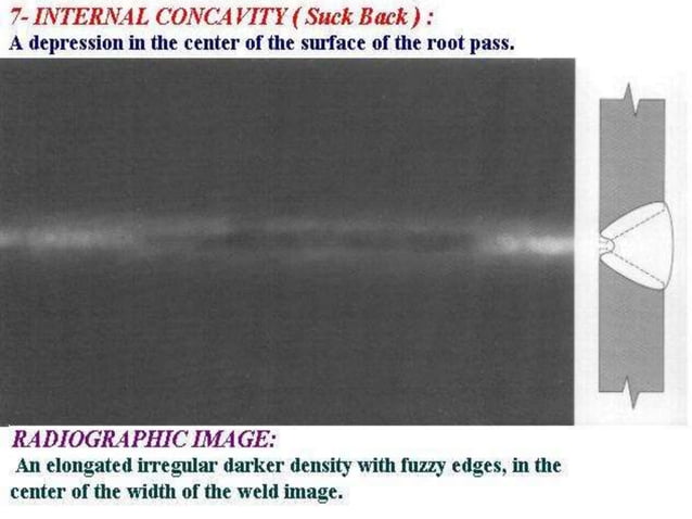 Types of Radio Graphic (RT) Weld Examination Defects.ppt | Medical ...