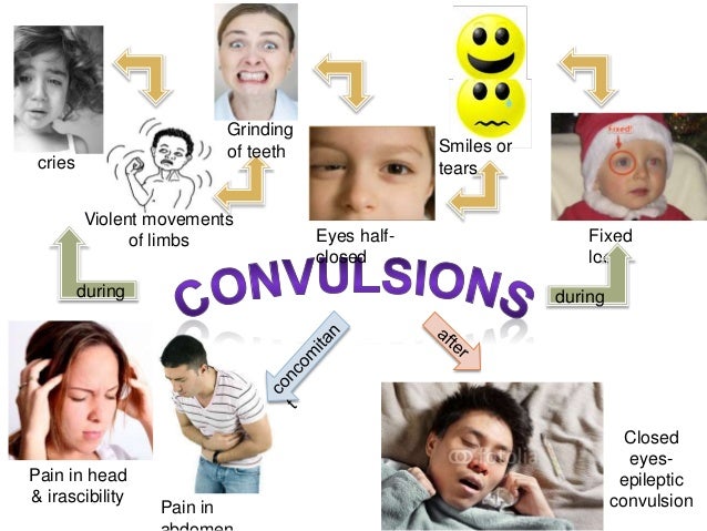 Trios of convulsions