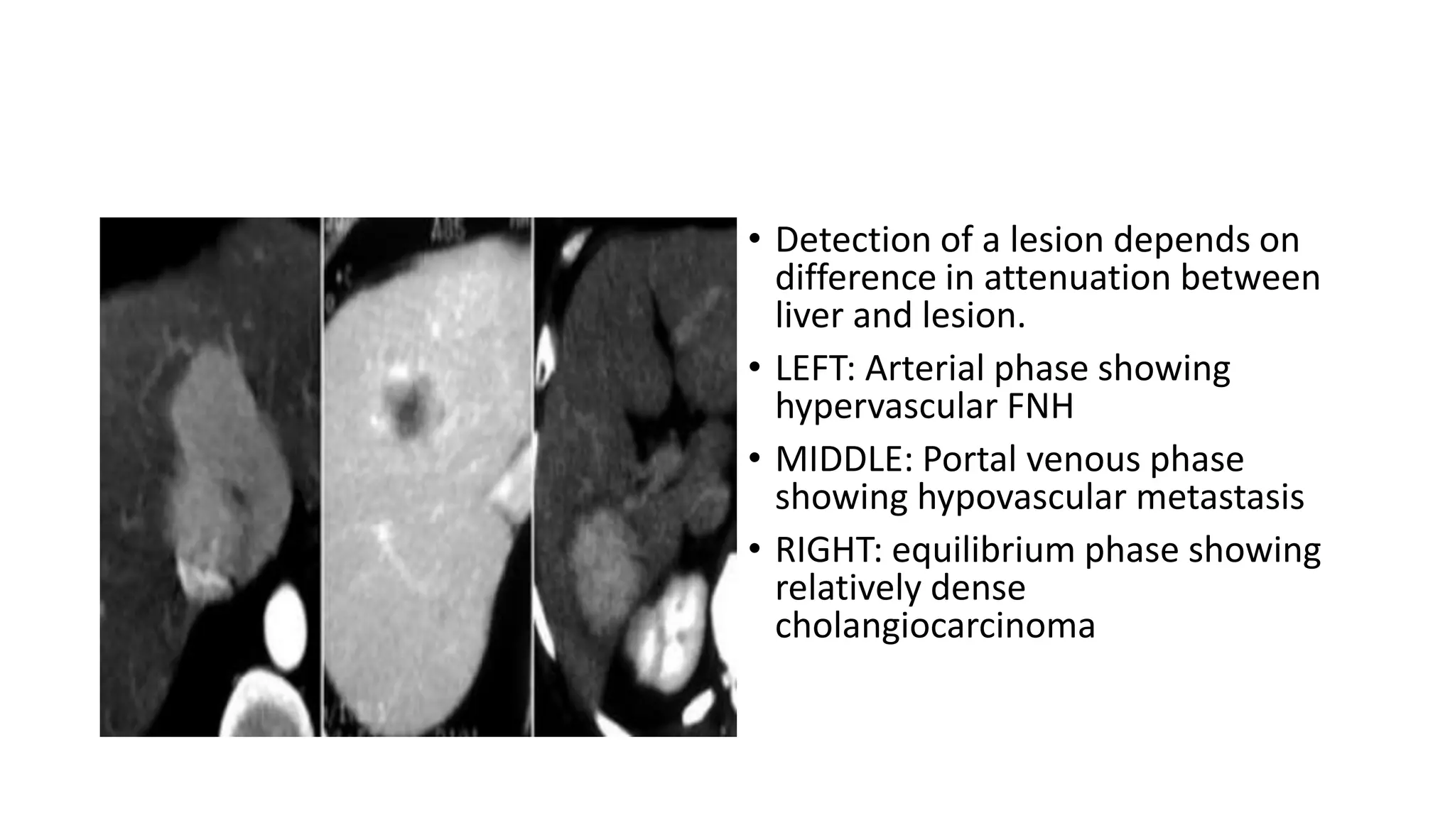 Triphasic CT scan | PPTX