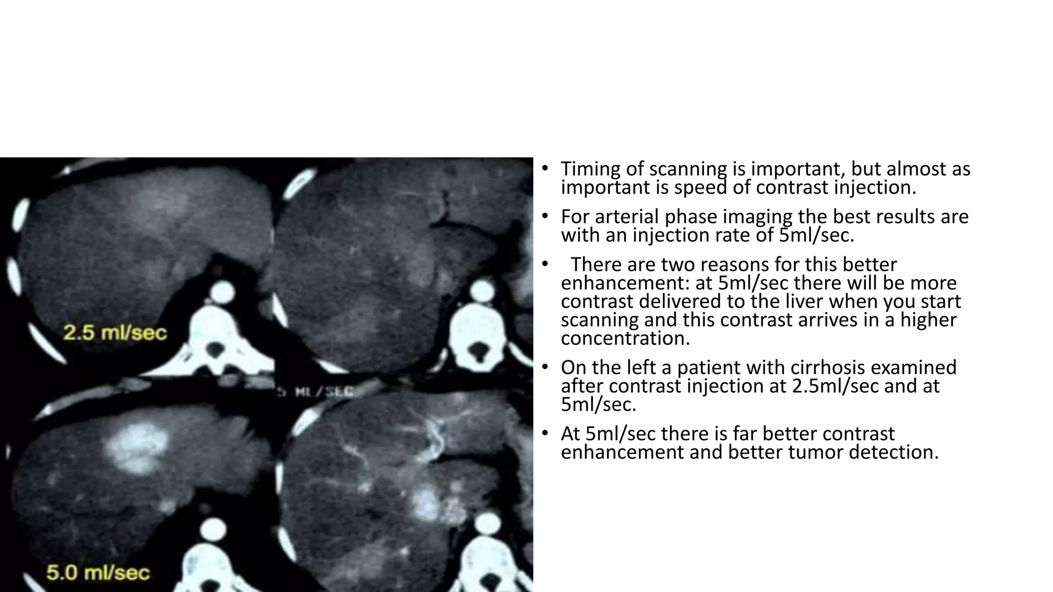 Triphasic CT scan | PPTX