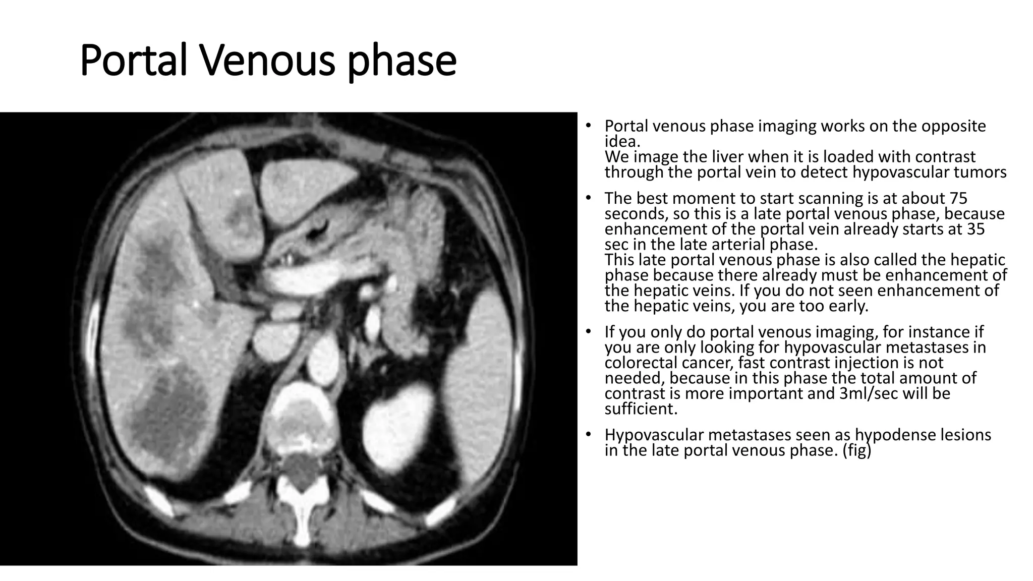 Triphasic CT scan | PPTX